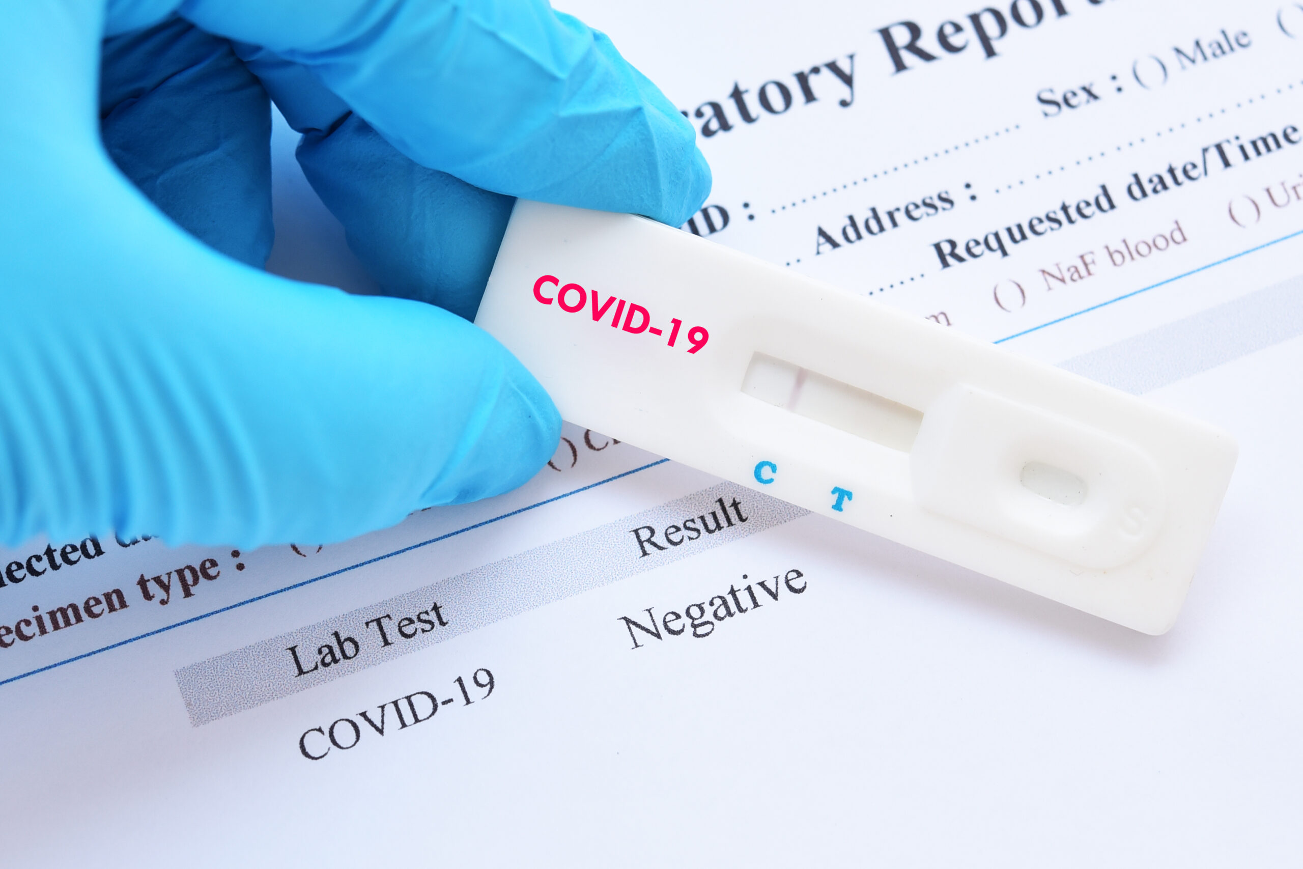 Combating the Pandemic with Validated COVID-19 Test Kits - KGK Science Inc.